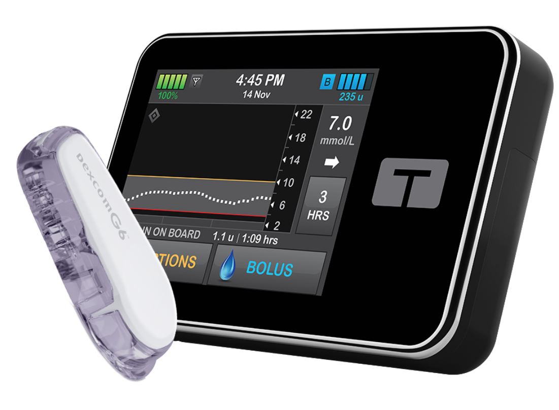 tandem_insulin_pump_dexcom_g6 - RNU "Radio Brčko" Brčko distrikt BiH